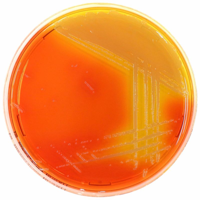 Burkholderia cepacia Selective Agar USP - EWC Diagnostics