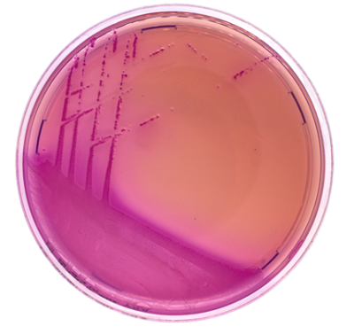 Yersinia Selective Agar - EWC Diagnostics