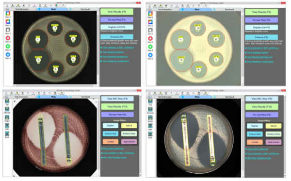 New BIOMIC V3 Optical System Delivers Higher Image Resolution - EWC Diagnostics